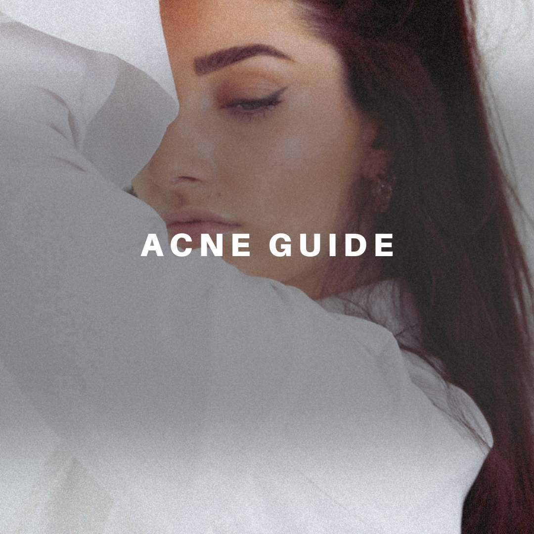 The Smash Acne Guide – SMASH SKIN